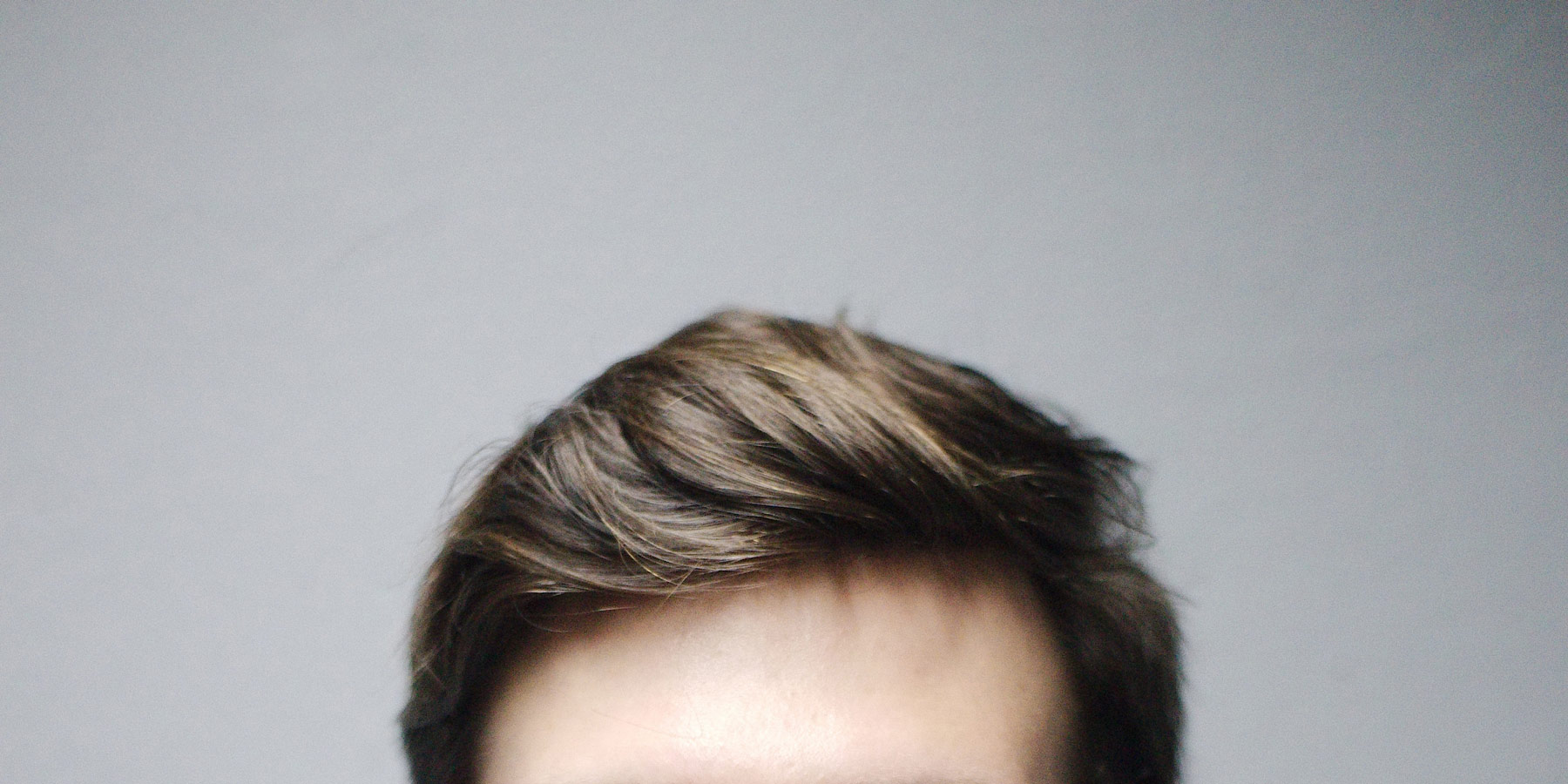 greffe de cheveux DHI - Transplantation capillaire sans cicatrice